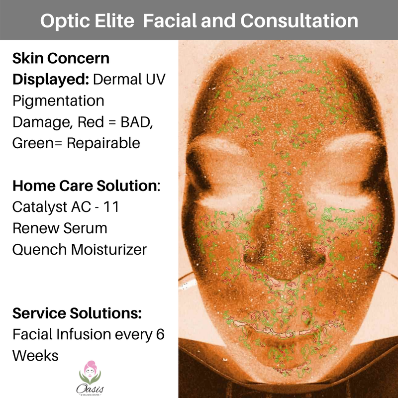 Oasis Skin Analysis and Consultation | Oasis Skin & Wellness Clinic Inc.