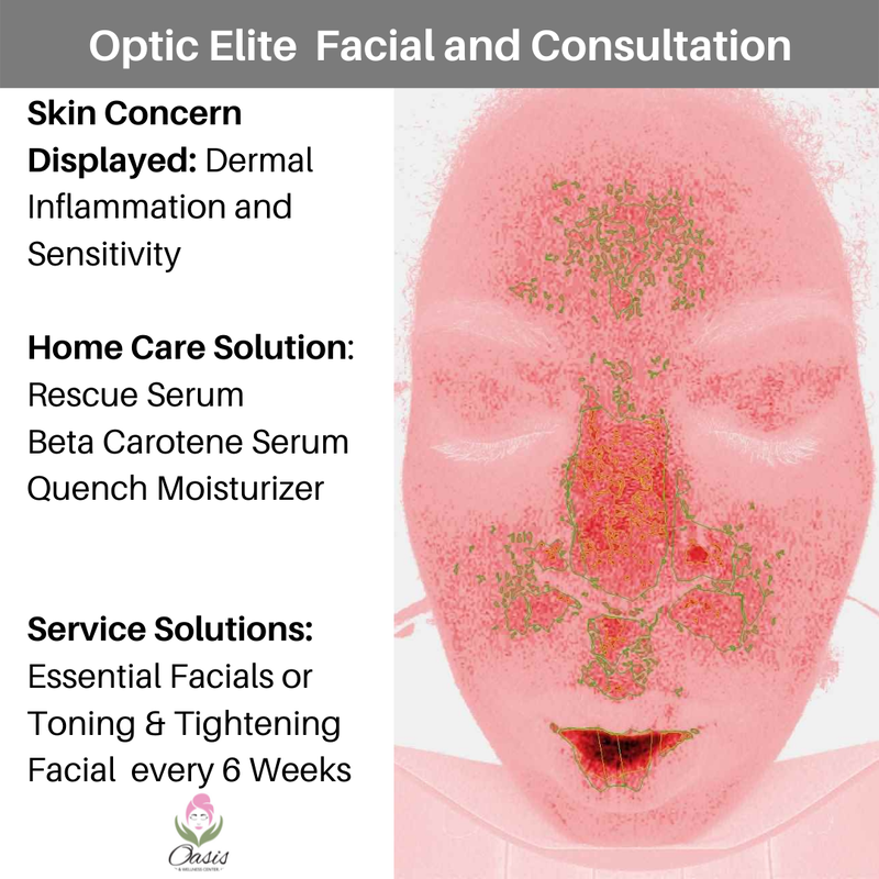 Oasis Skin Analysis and Consultation | Oasis Skin & Wellness Clinic Inc.