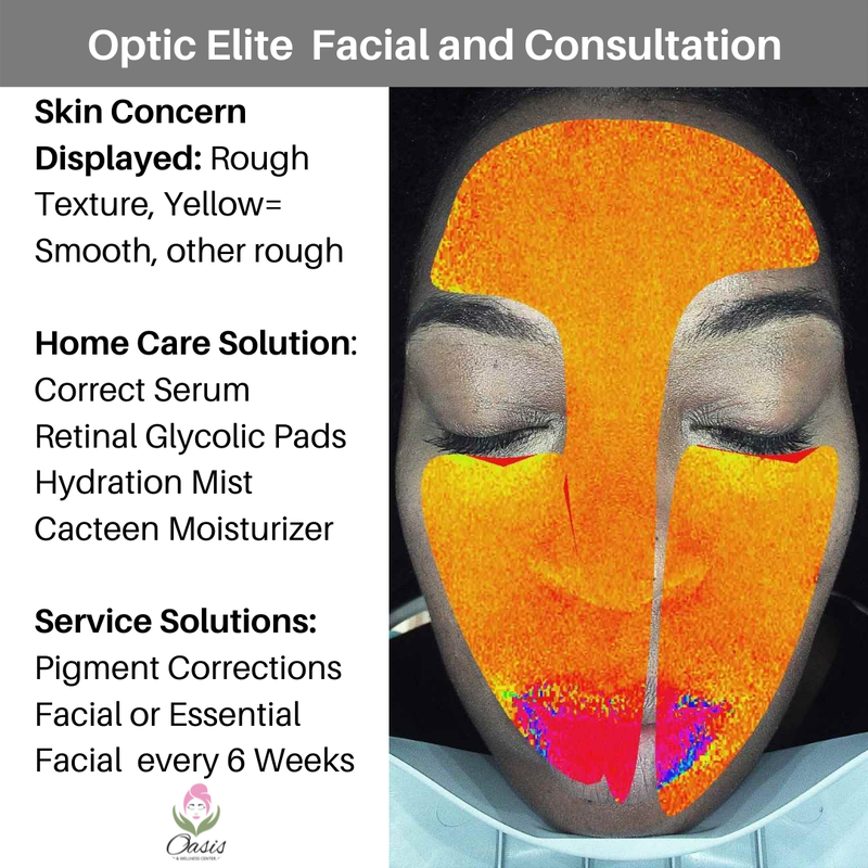 Oasis Skin Analysis and Consultation | Oasis Skin & Wellness Clinic Inc.