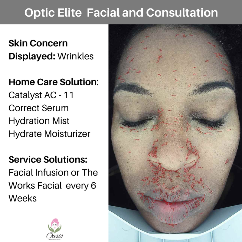 Oasis Skin Analysis and Consultation | Oasis Skin & Wellness Clinic Inc.